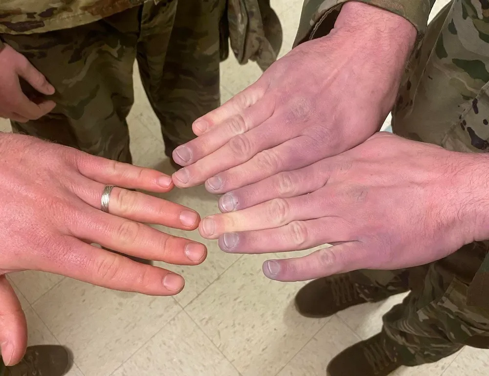 10+ Warning Signs Of Low Testosterone In Men - happilydiy